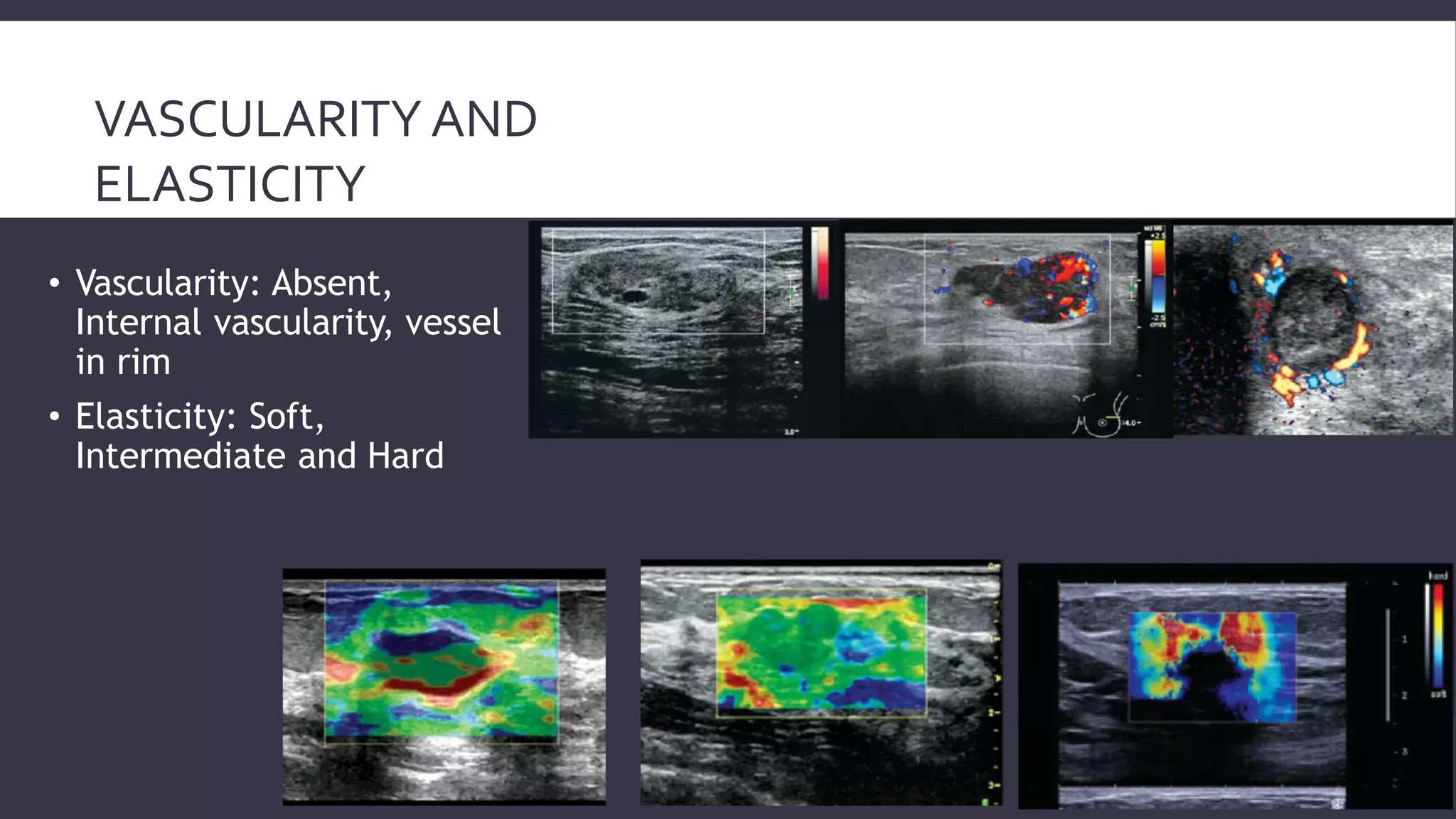 Role of sonography and mri in breast pathology pdf | PDF