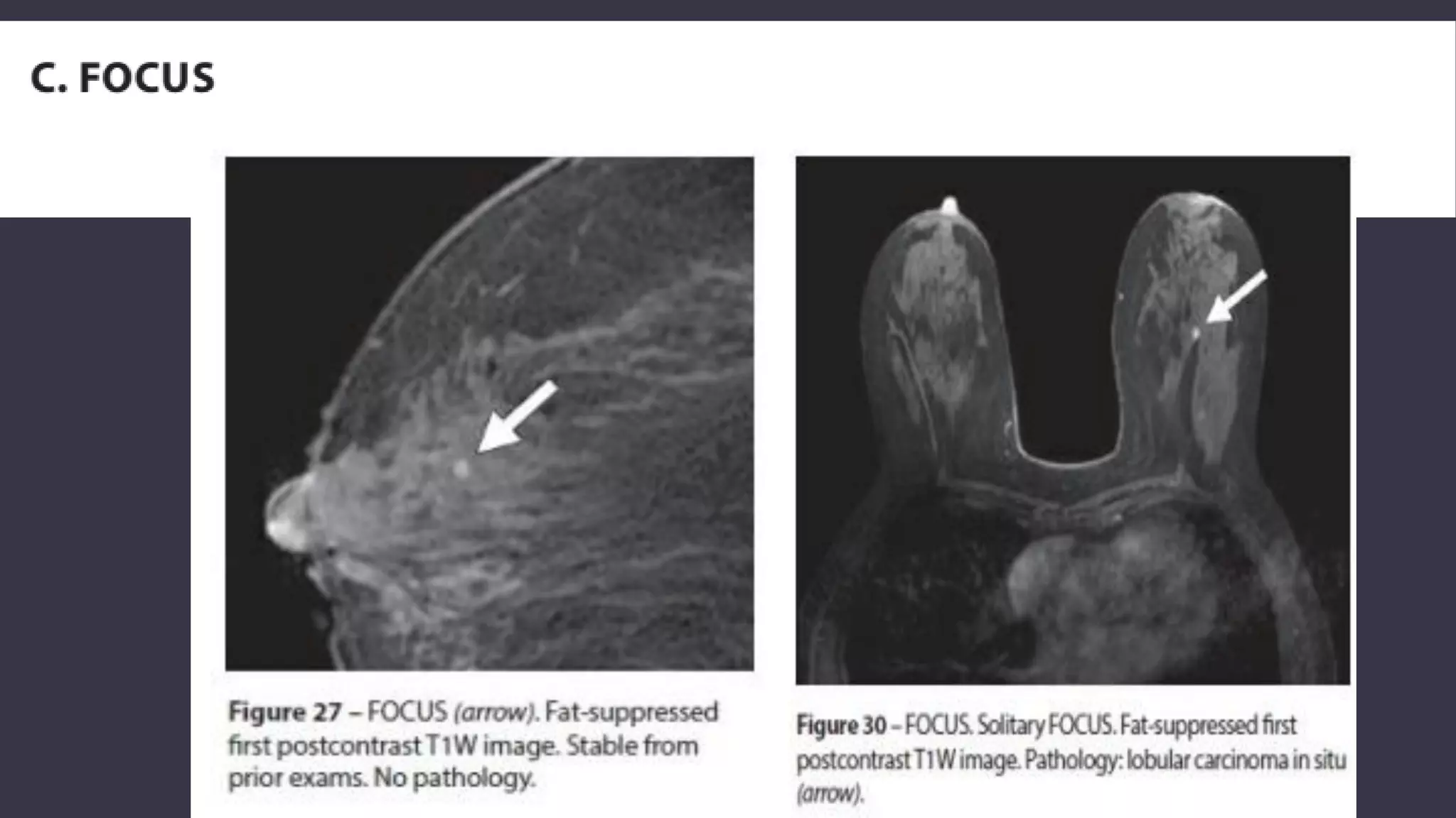Role of sonography and mri in breast pathology pdf | PDF
