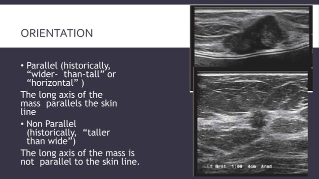 Role of sonography and mri in breast pathology pdf | PDF