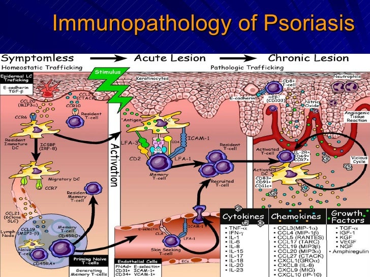 Role of stat3 protein & thelper 17 cell in psoriasis development…
