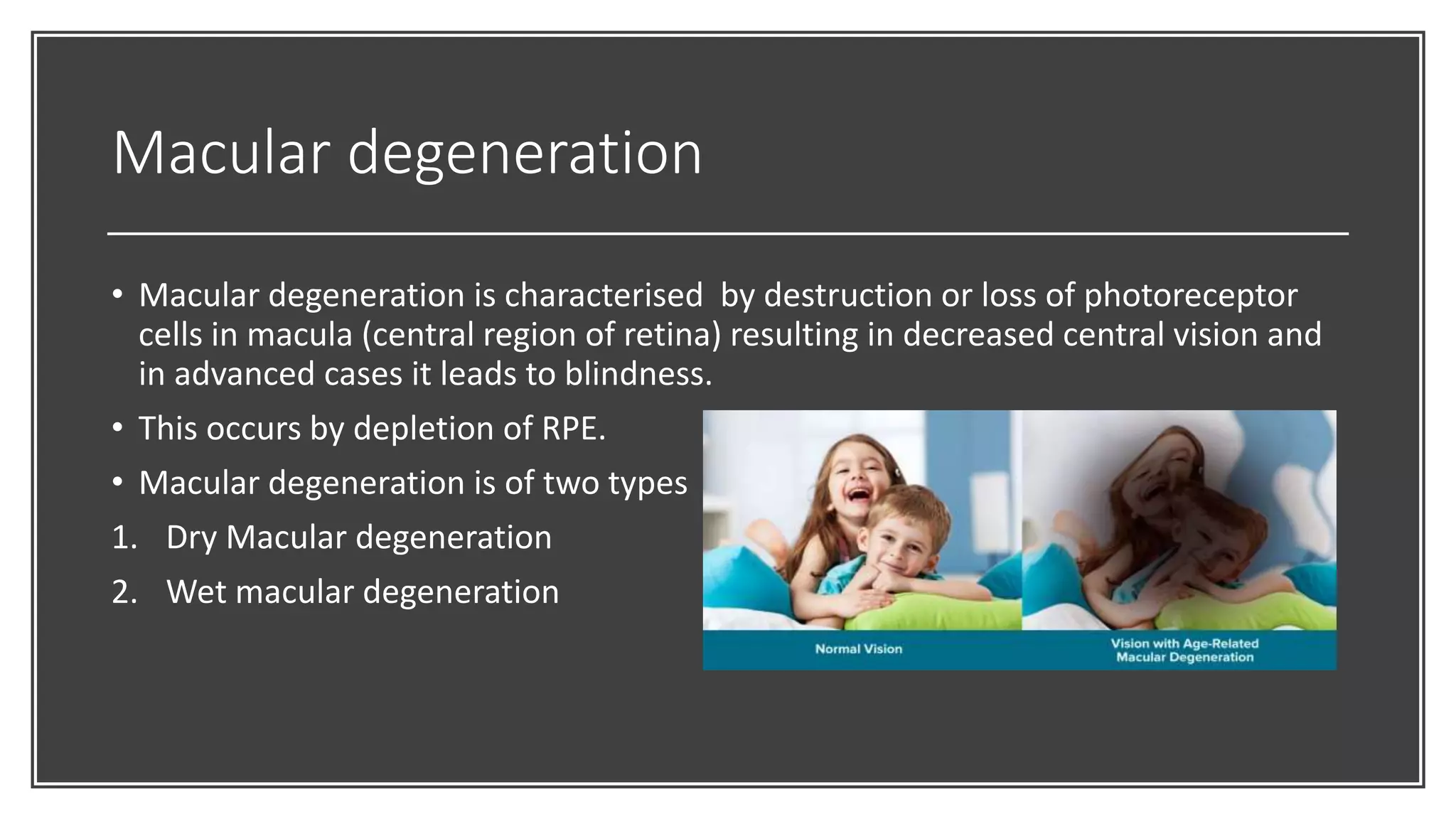 Role of stem cells in visual restoration | PPT