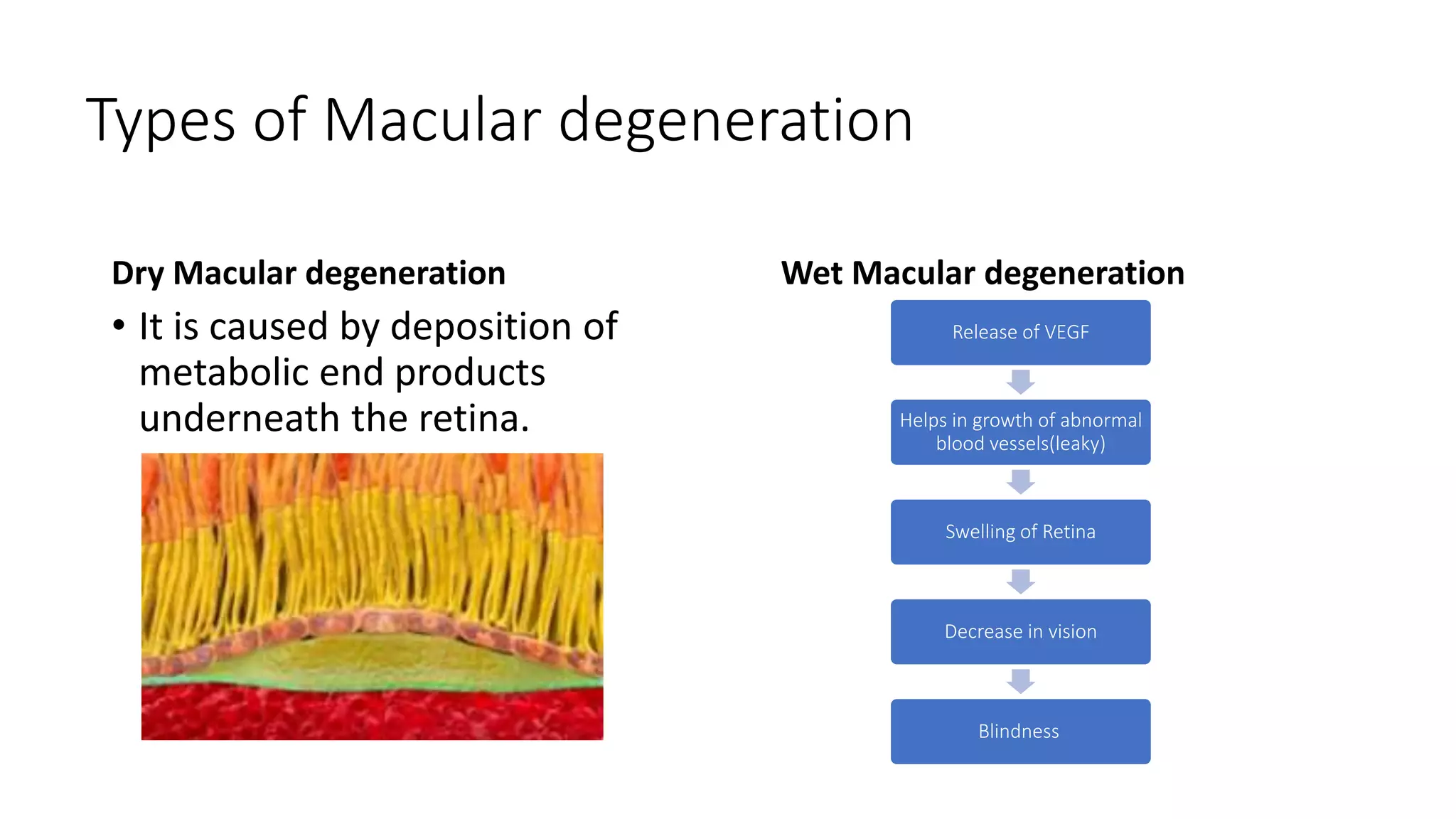 Role of stem cells in visual restoration | PPT