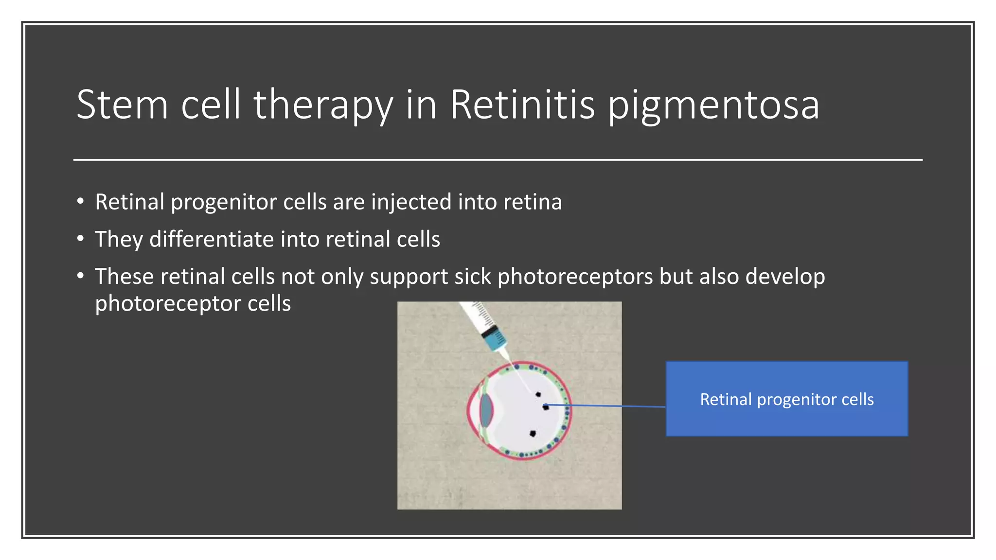 Role of stem cells in visual restoration | PPT