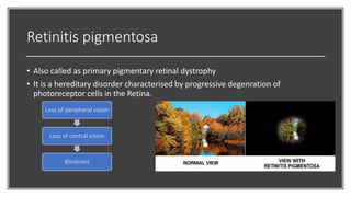 Role of stem cells in visual restoration | PPT