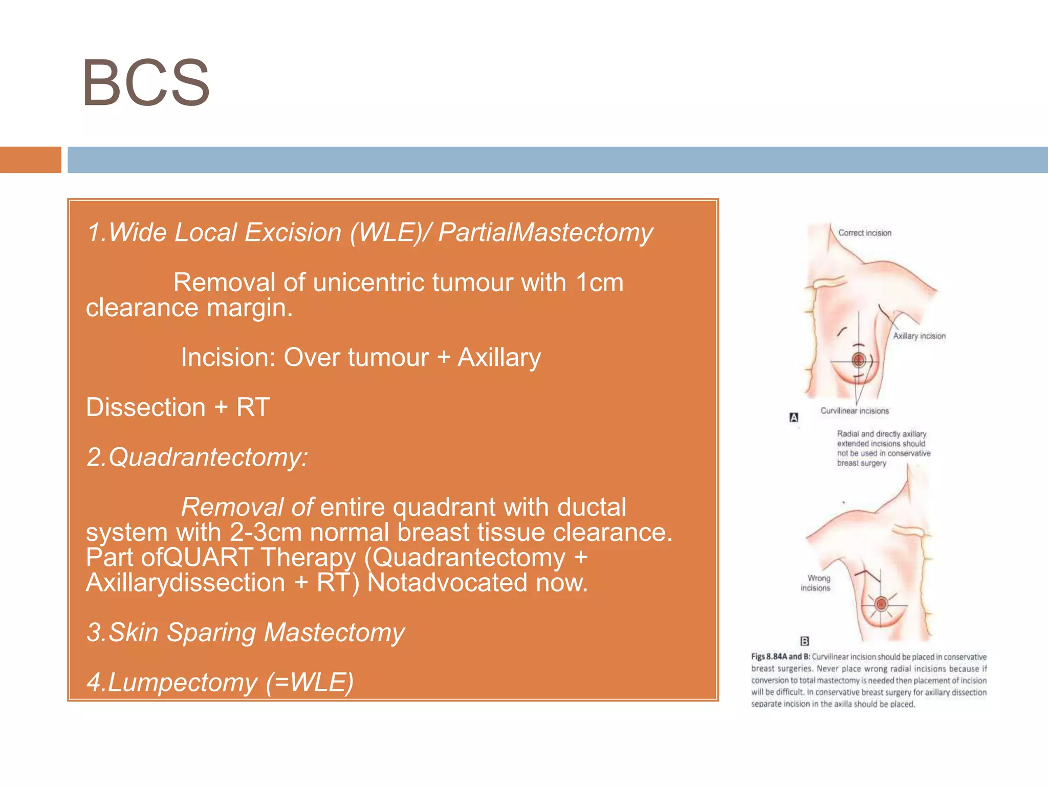 Role of surgery in carcinoma breast n | PPTX