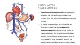 ROLE OF SURGERY IN PORTAL HYPERTENSION evolving.pptx