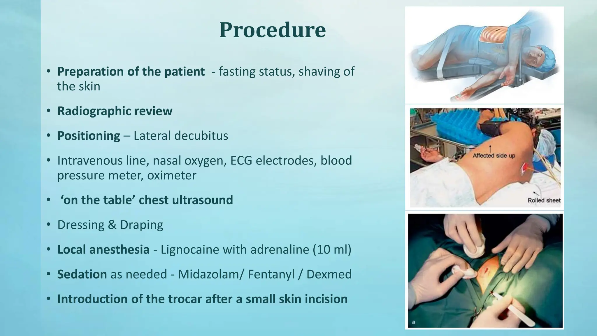 Role of Thoracoscopy in Pleural Disease.pdf