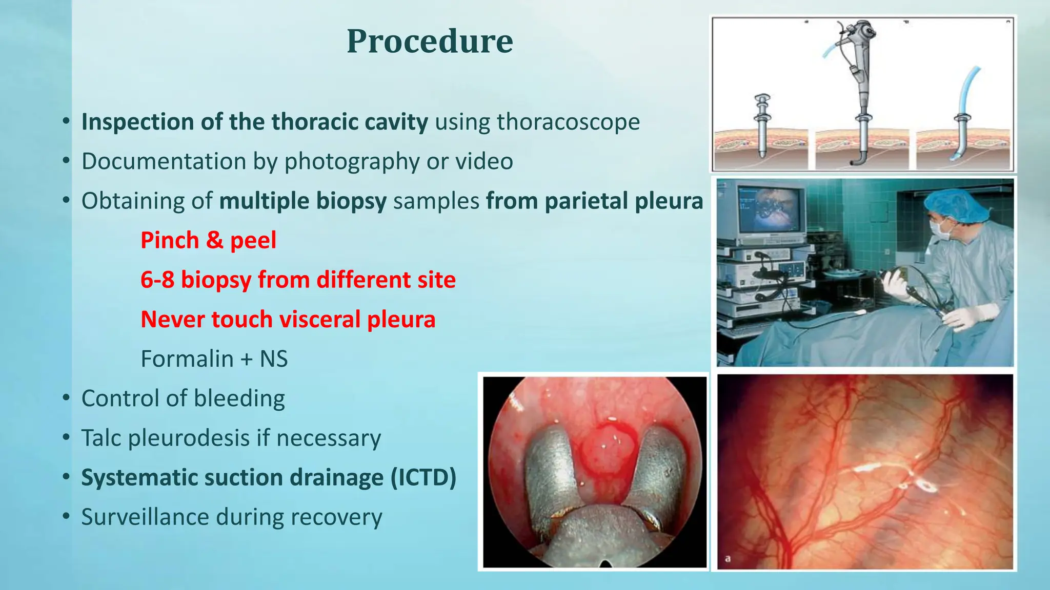 Role of Thoracoscopy in Pleural Disease.pdf