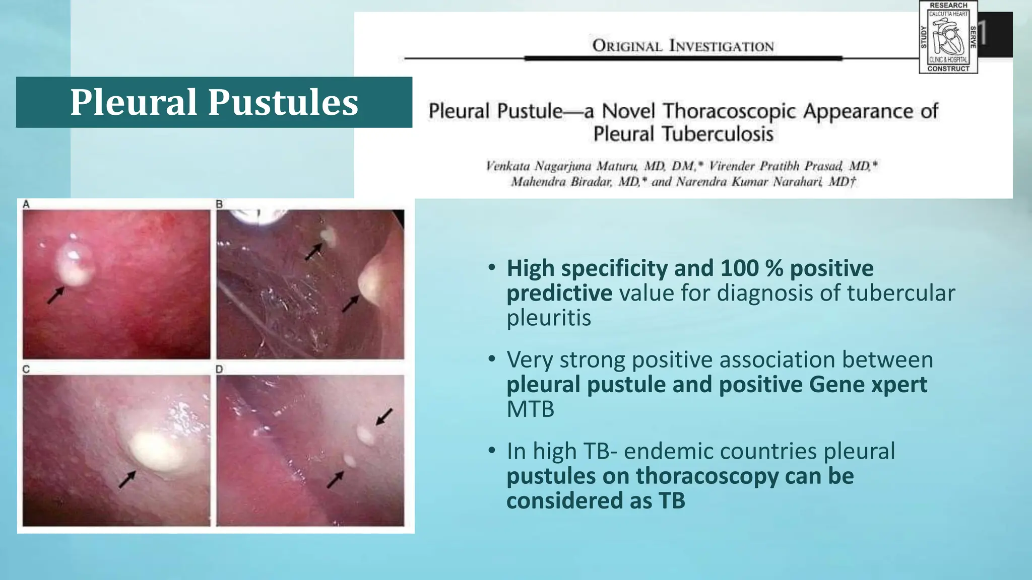 Role of Thoracoscopy in Pleural Disease.pdf