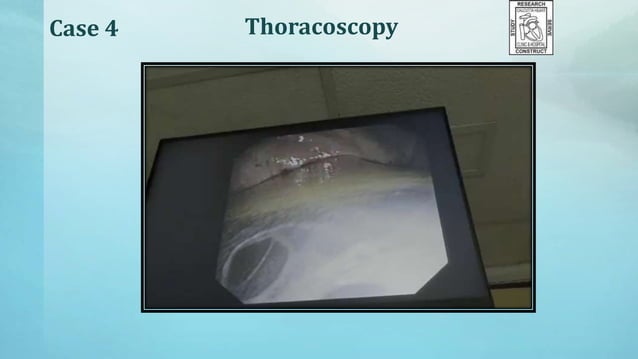 Role of Thoracoscopy in Pleural Disease.pdf