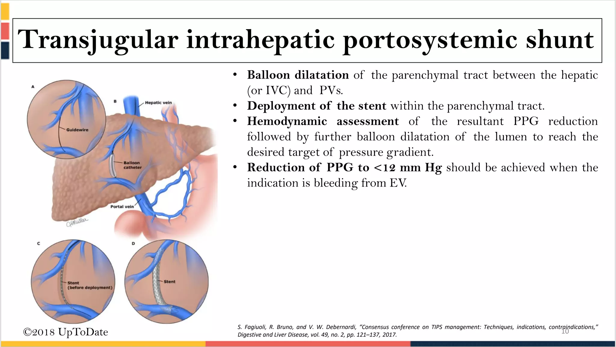 Role of tips in liver disease | PDF