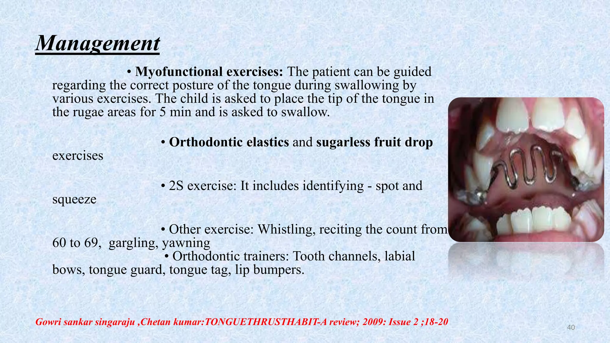 ROLE OF TONGUE IN DEVELOPMENT OF MALOCCLUSION | PPTX