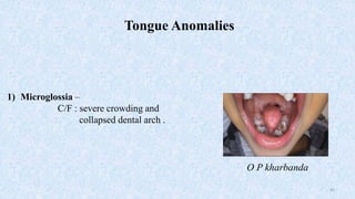 ROLE OF TONGUE IN DEVELOPMENT OF MALOCCLUSION | PPTX