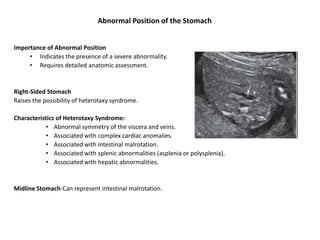 ROLE OF ULTRASOUND IN ASSESSING FETAL GIT- final (1).pptx