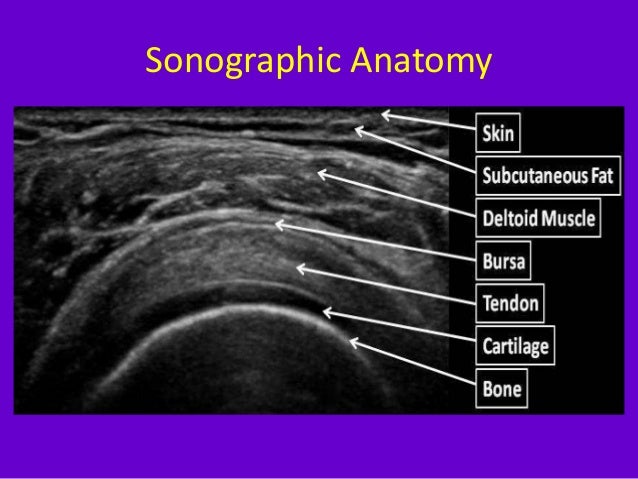 Role of ultrasound in clinical evaluation of shoulder Dr. Muhammad Bi…