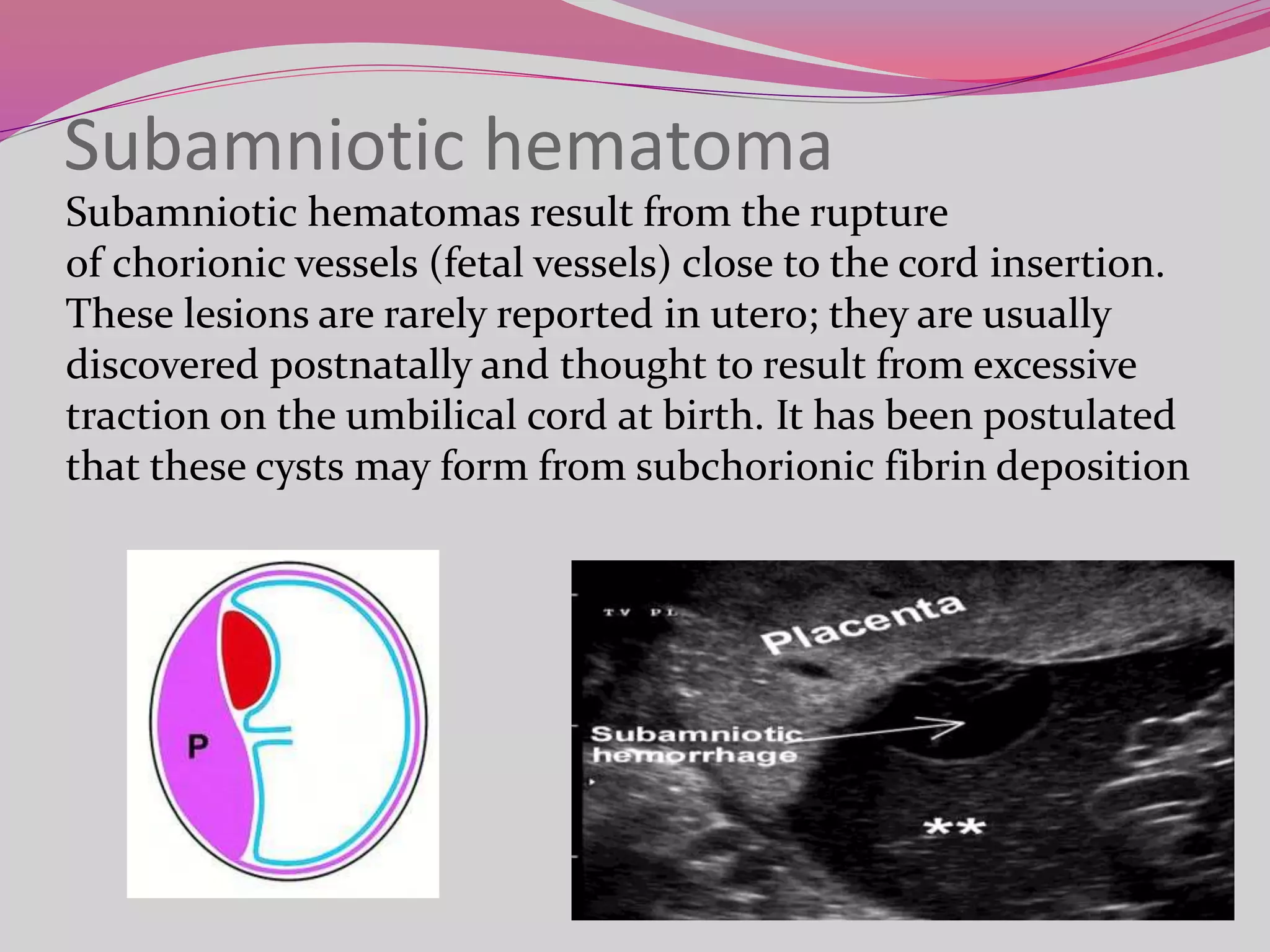 Role of ultrasound in emergency obstetrics . | PPTX