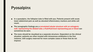 Role of ultrasound in right iliac fossa pain | PPTX