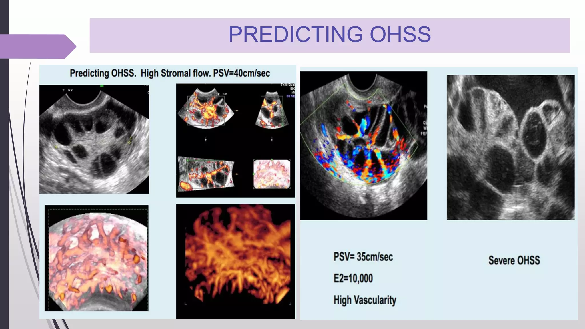 Role of ultrasound in the Infertility management | PPTX