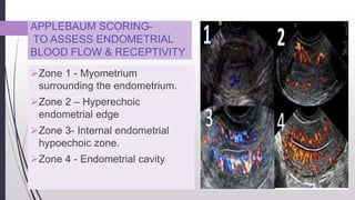 Role of ultrasound in the Infertility management | PPTX