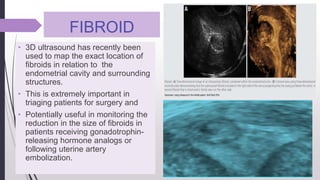 Role of ultrasound in the Infertility management | PPTX