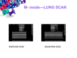Role of ultrasound nurse in critical care | PPTX
