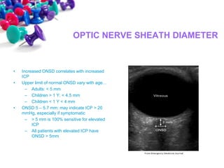 Role of ultrasound nurse in critical care | PPTX