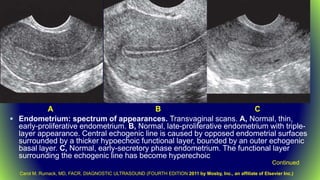 Role of us in evaluation of infertility Dr. Muhammad Bin Zulfiqar | PPT