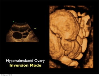 Role of us in pelvic pain final | PDF