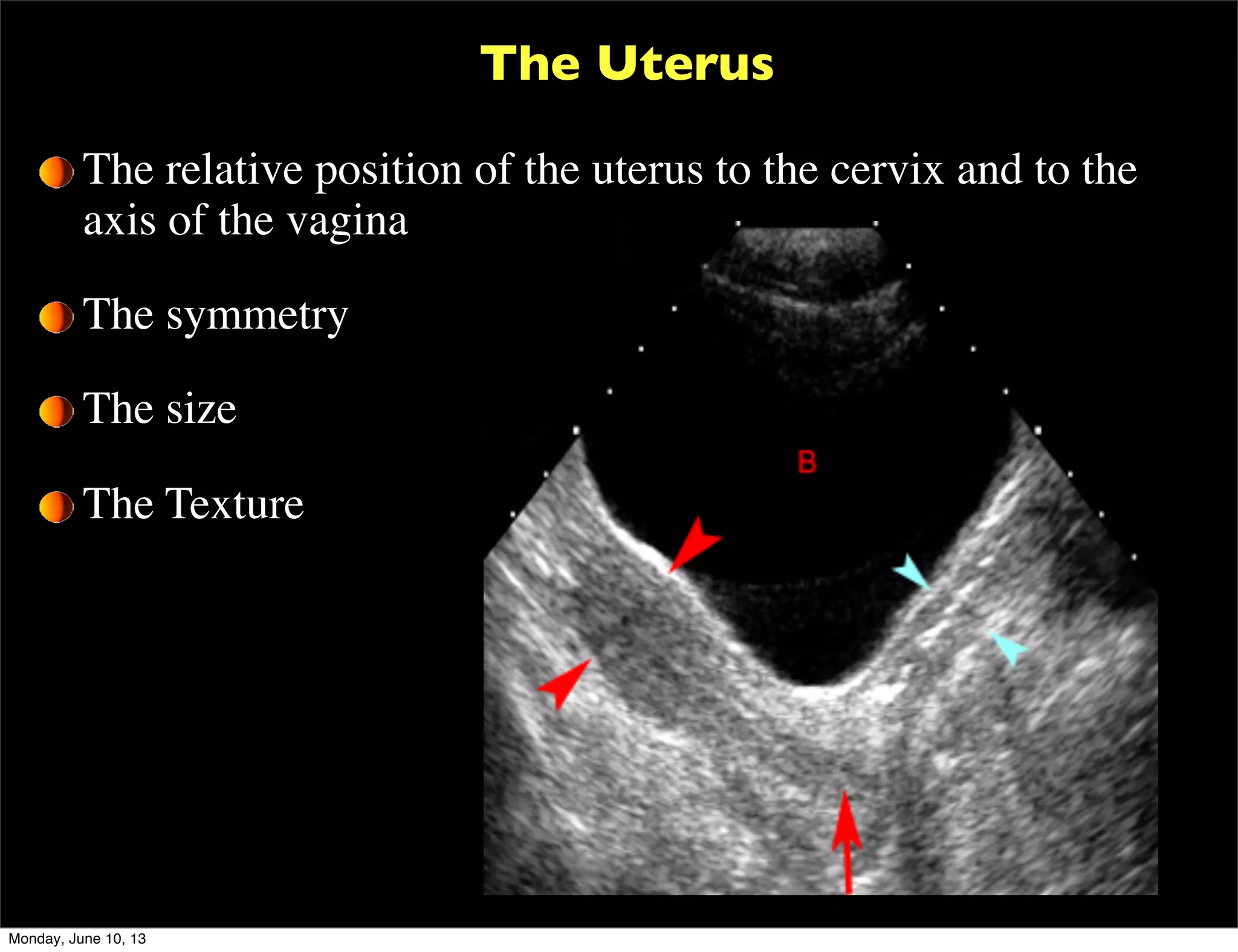 Role of us in pelvic pain final | PDF