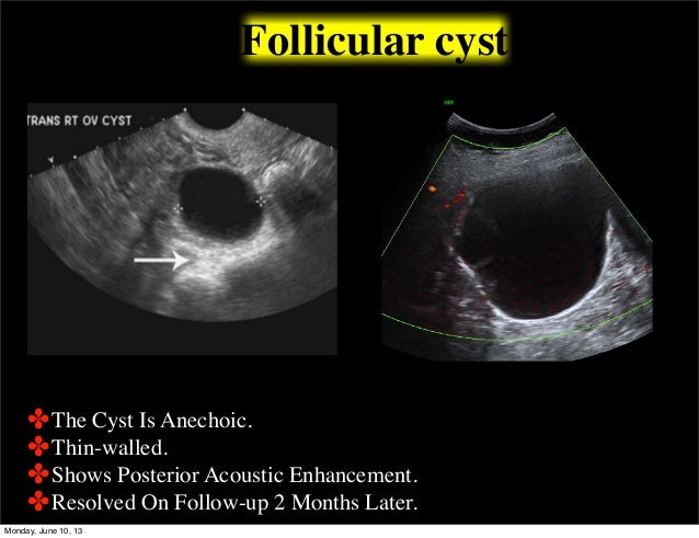 Role of us in pelvic pain final