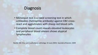 Role of virus in periodontal diseases | PPTX