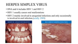 Role of virus in periodontal disease | PPTX