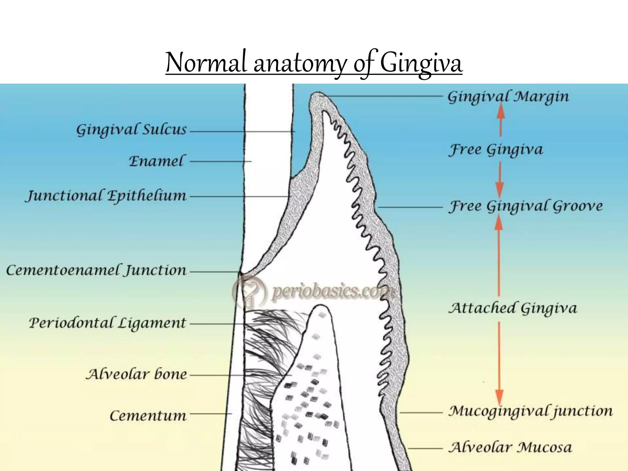 clinical features of gingivitis | PPTX