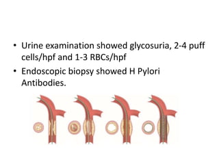 Case Presentation in SOAP format on Ischemic Heart Disease with Acute ...