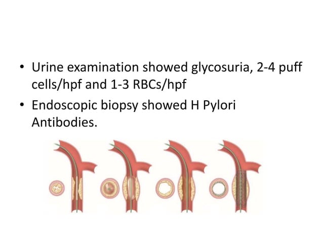 Case Presentation in SOAP format on Ischemic Heart Disease with Acute ...