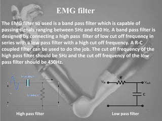 Bionic Arm Using EMG Processing | PPTX