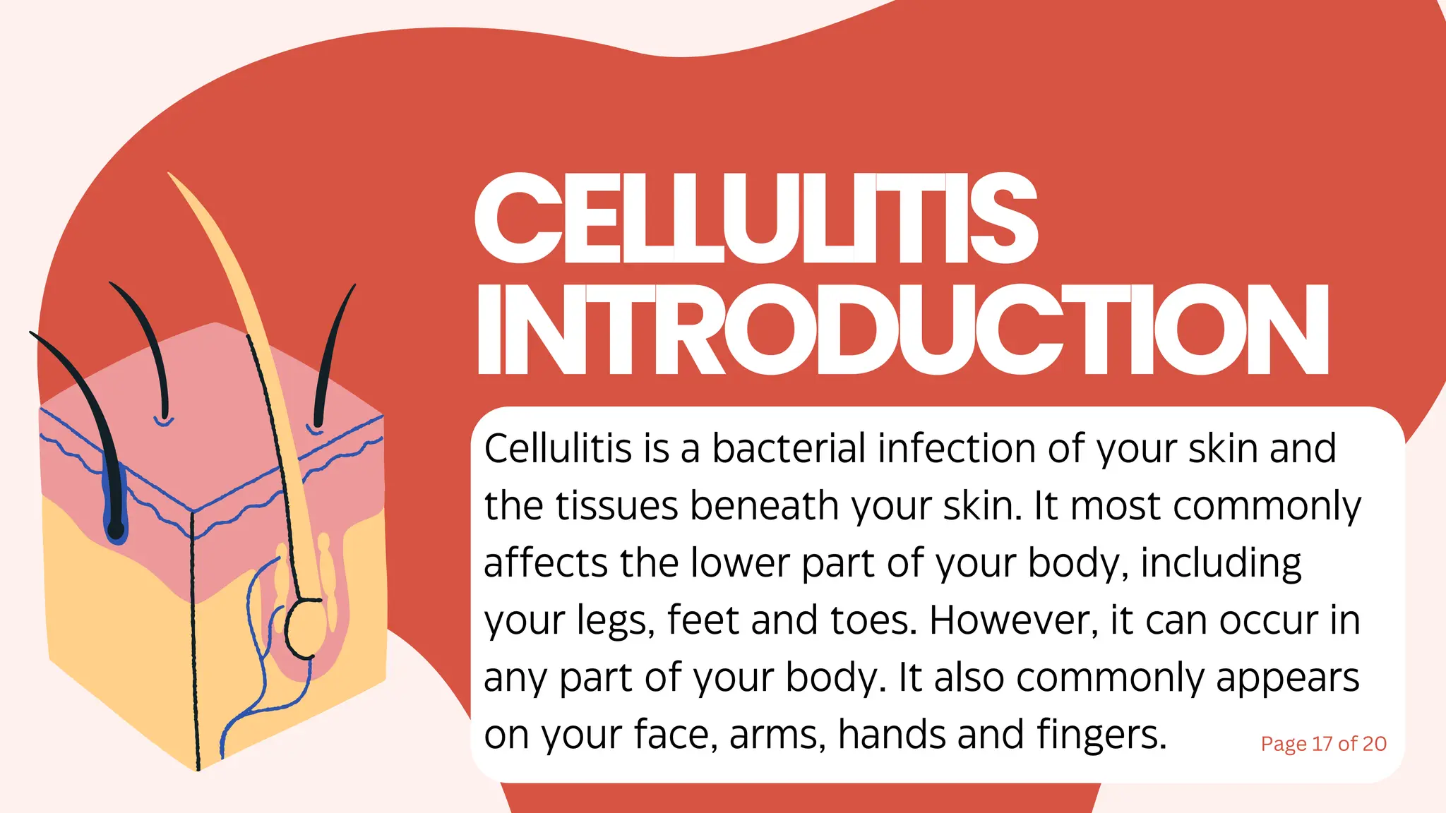 Roll No 35- Eczema, Psoriasis, Cellulitis_.pdf