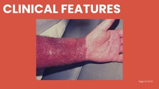 Roll No 35- Eczema, Psoriasis, Cellulitis_.pdf
