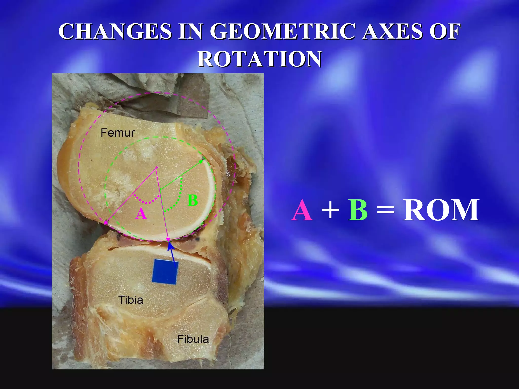 Range of Motion Study | PPT