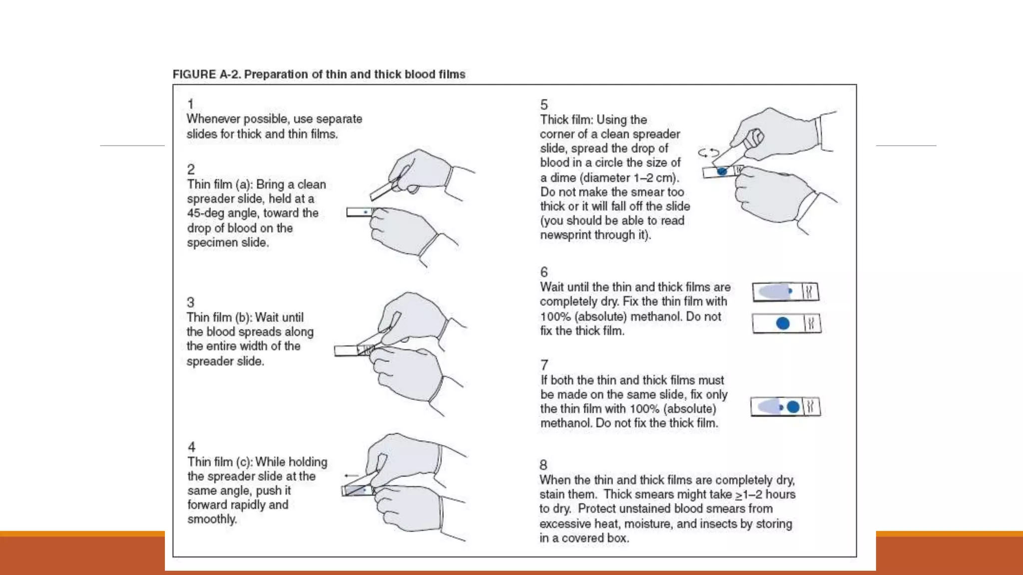 Romanowsky stain | PPTX