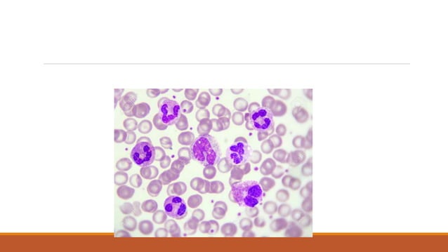 Romanowsky stain | PPTX