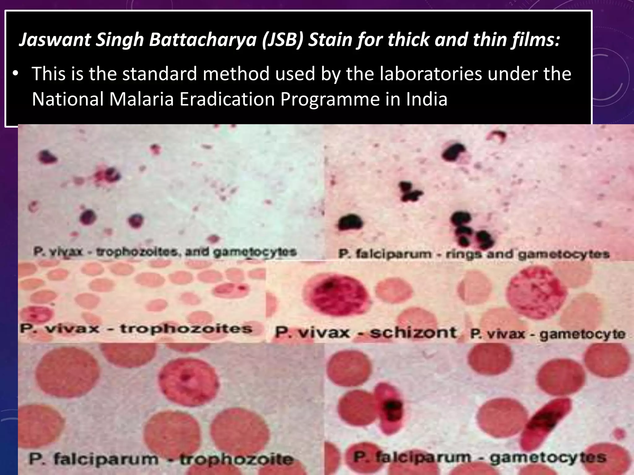 Romanowsky stains | PPT