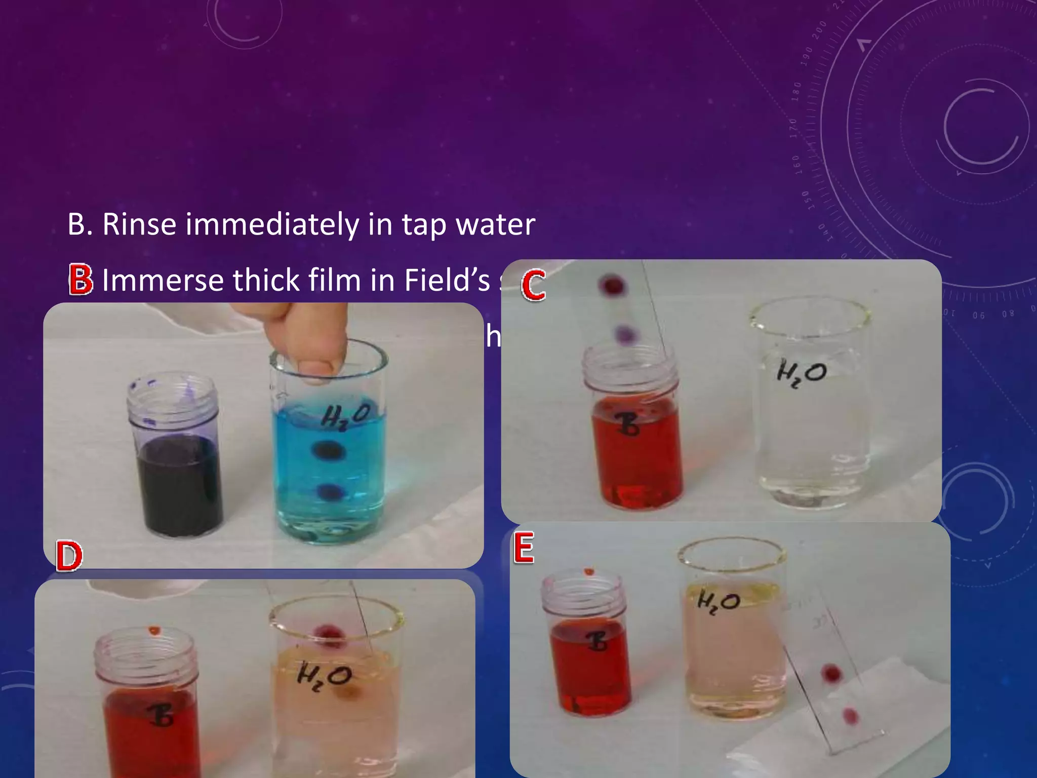 Romanowsky stains. Dr. Abhinav Golla , Associate Professor , Lab ...
