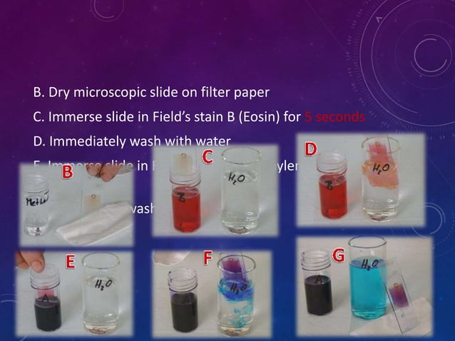 Romanowsky stains | PPT