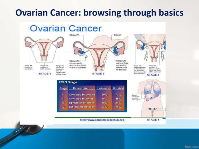 ROMA (Risk of Ovarian Malignancy Algorithm)