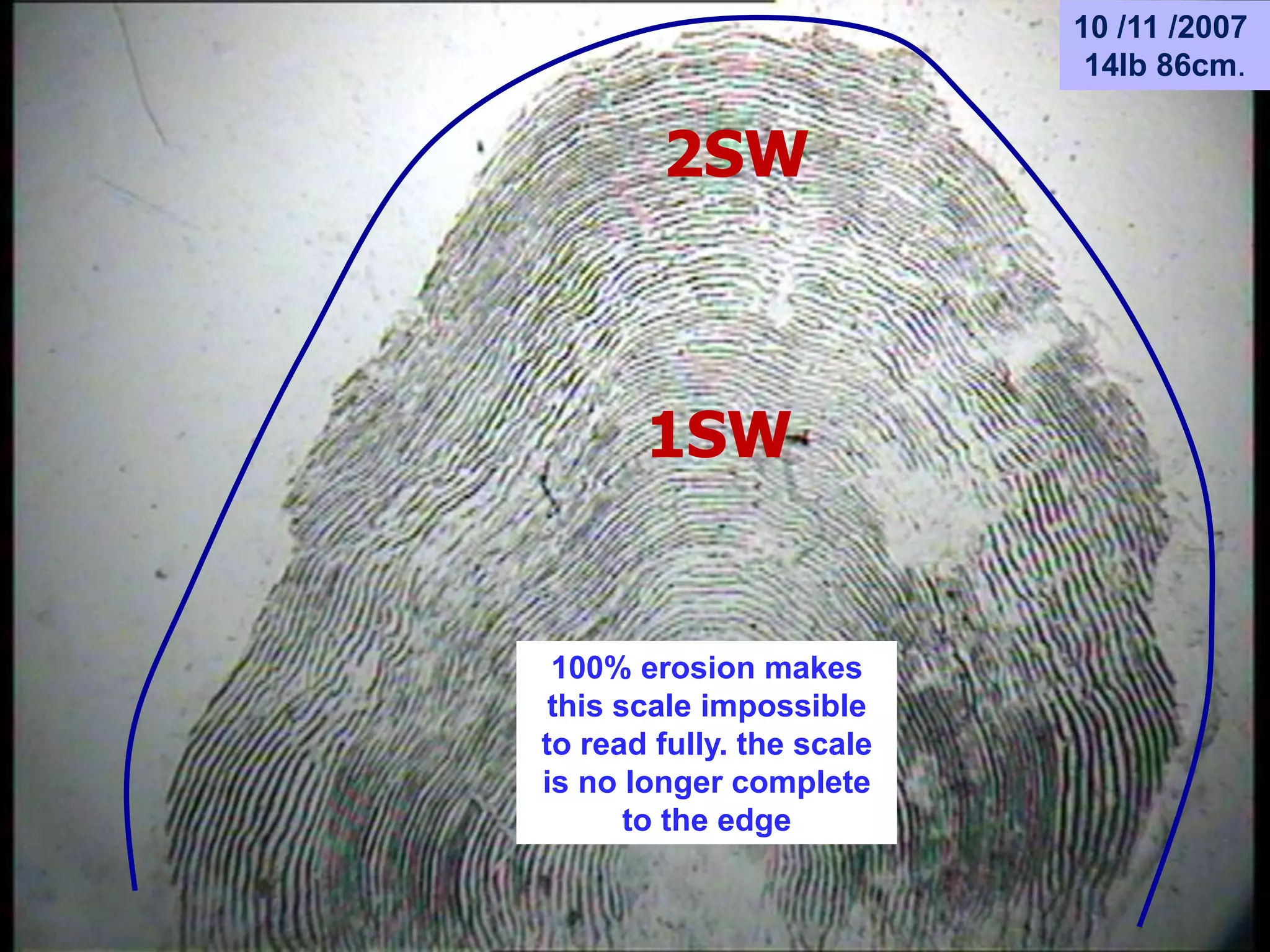 Part 2: Salmon scale reading; 'Problem scales', Erosion, Spawning Marks ...