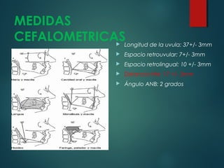 RONCOPATIA: SAHOS - CIRUGIA MULTINIVEL. | PPT