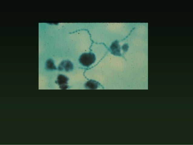 Mastitis: A Reaction of the Immune System- Ron Erskine