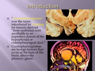 craniopharyngioma | PPTX