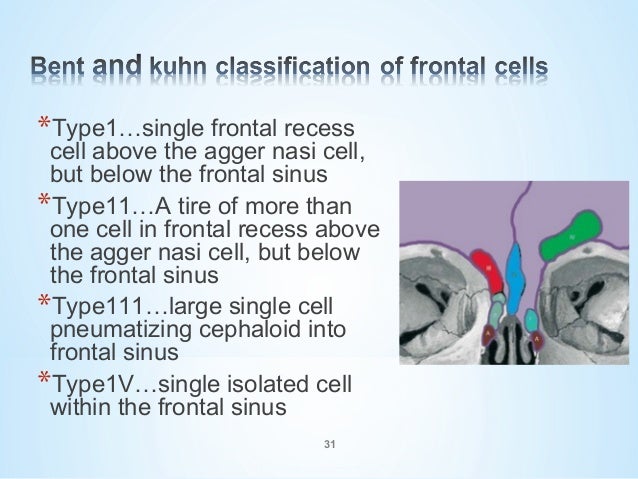 ANATOMY OF PNS BY ROOHIA